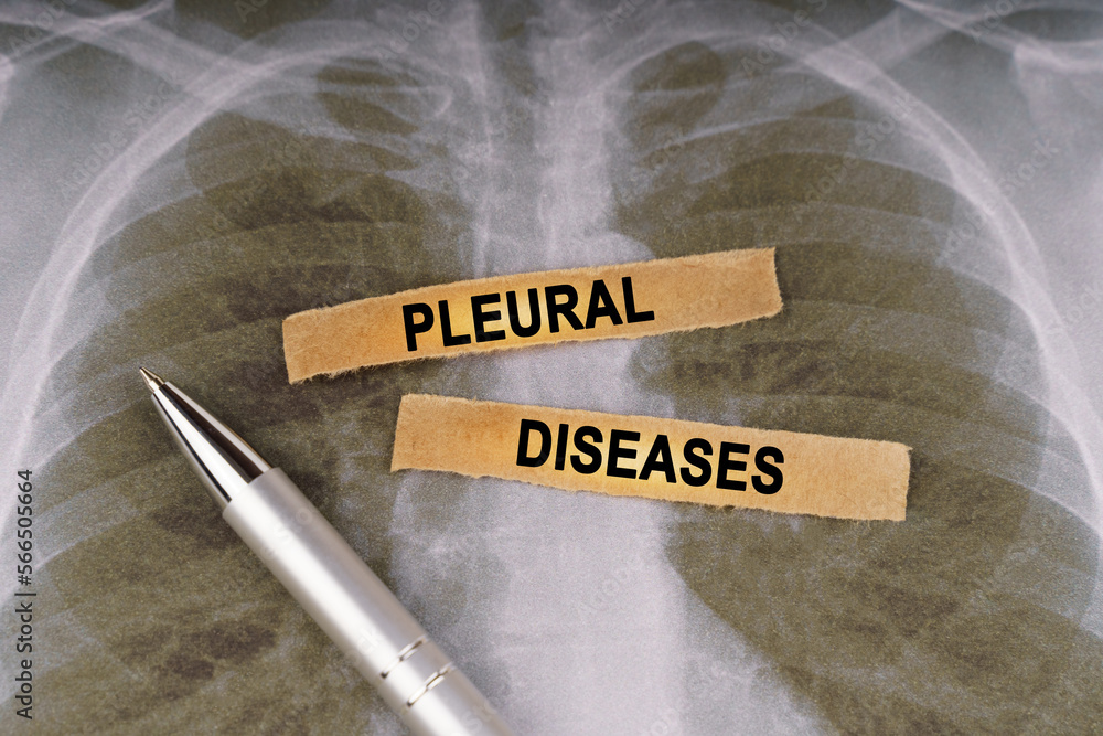 On a human chest x-ray, a pen and strips of paper labeled - PLEURAL ...