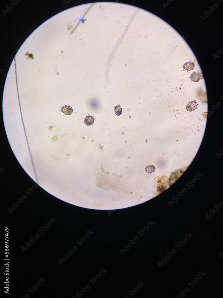 Notoedres cati under the microscope. Notoedric mange, also referred to ...