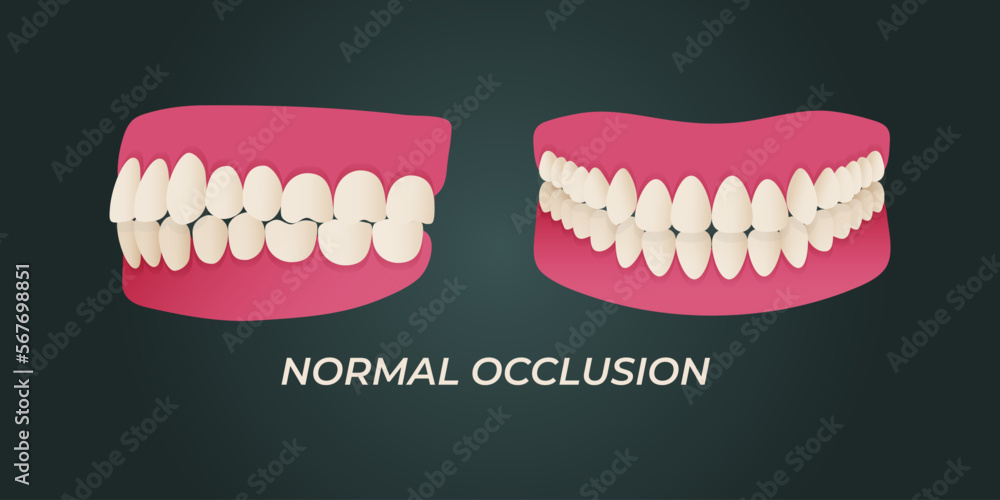 Medical dental diagram illustration. Orthodontist human tooth anatomy ...