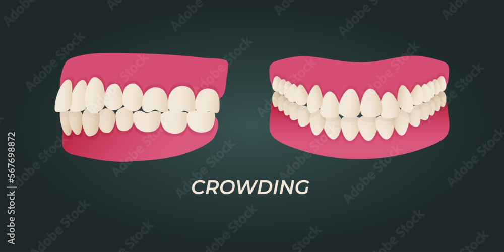 Medical dental diagram illustration. Orthodontist human tooth anatomy ...