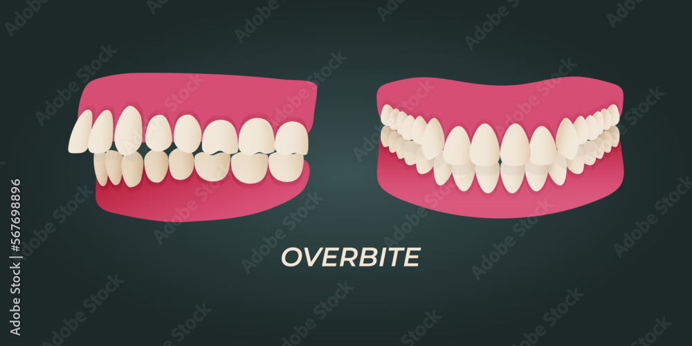 Medical dental diagram illustration. Orthodontist human tooth anatomy ...