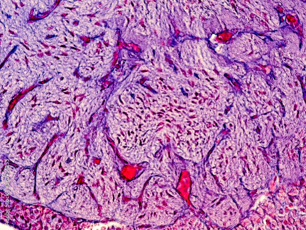guinea pig hypophysis (pituitary gland) under the microscope, posterior ...