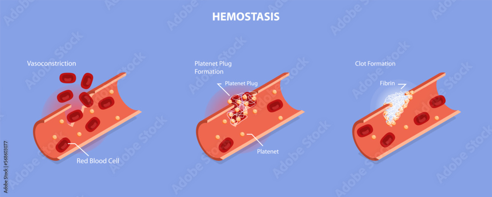 3D Isometric Flat Vector Conceptual Illustration of Hemostasis, Wound ...