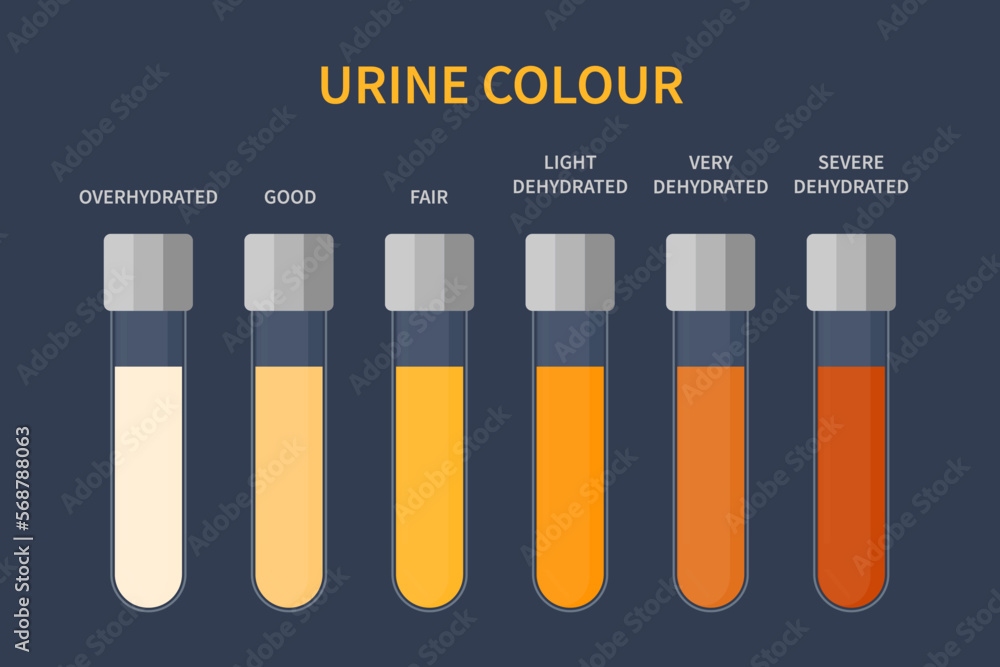 Vector de Stock Urine colour chart. Hydration and dehydration level ...