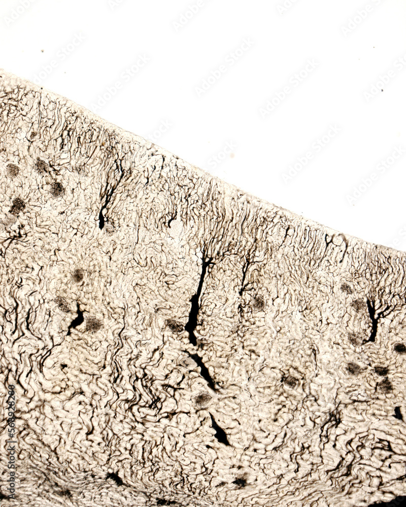 Kidney. Renal cortex. Blood vessels Stock Photo | Adobe Stock