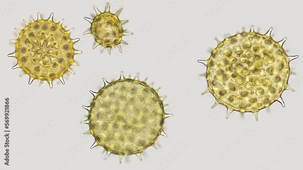 Hibiscus pollen grain under microscope. 400x objective. Selective focus ...