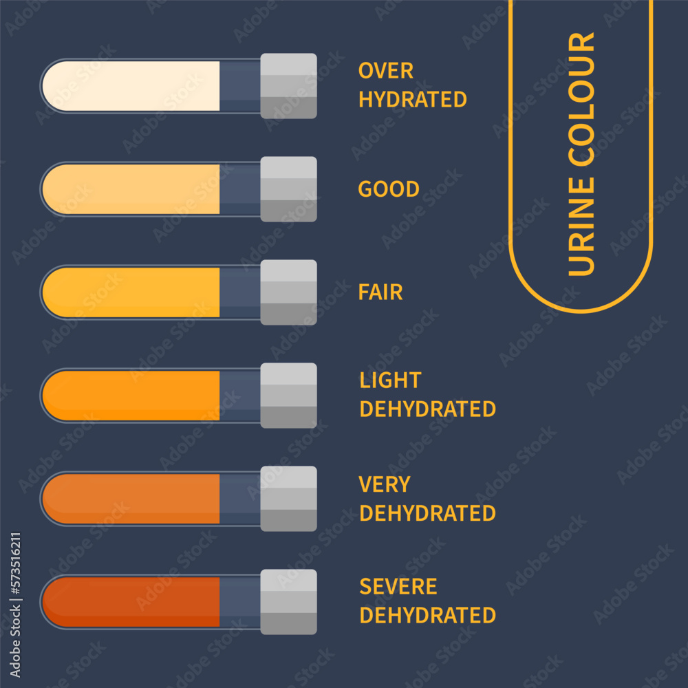 Vector de Stock Urine colour chart. Hydration and dehydration level ...