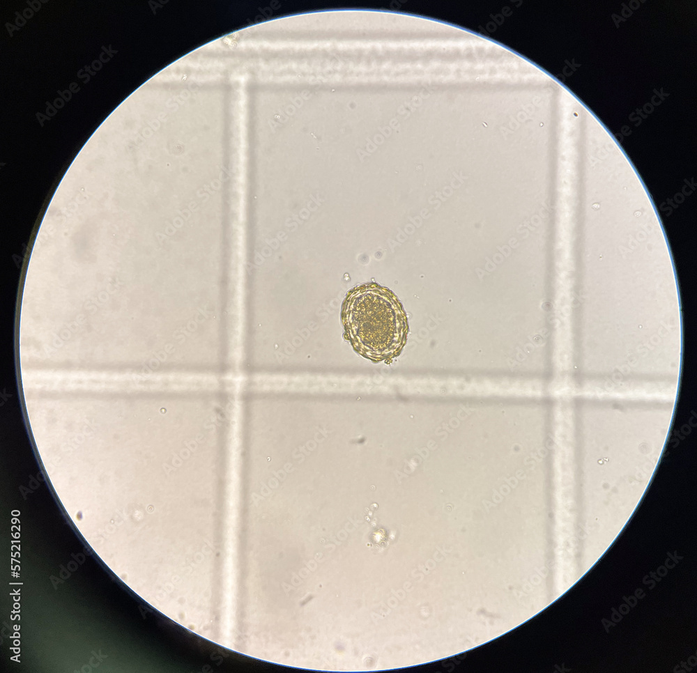 ascaris lumbricoides egg human parasite in stool examination. Stock ...