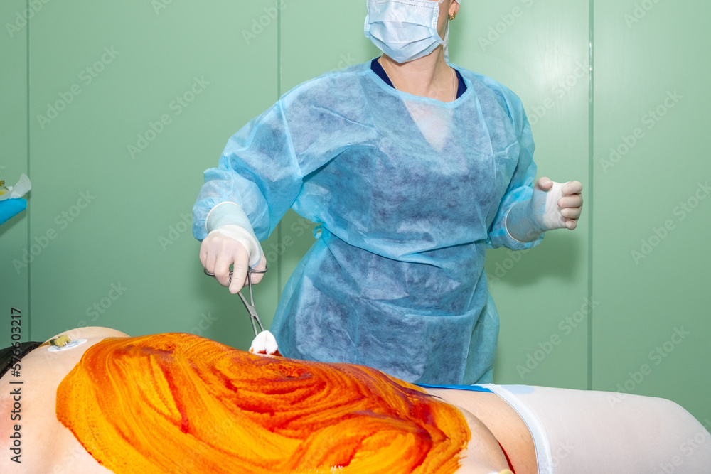 Before starting surgery, the doctor treats the patient's stomach with ...