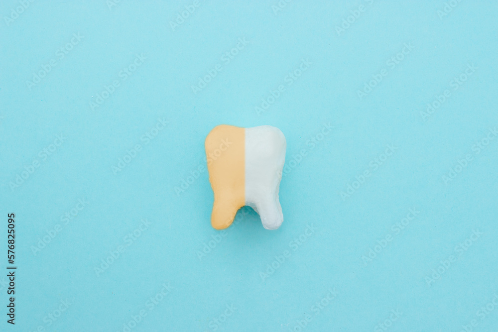 Unhealthy tooth white molar model with Clean and dirty tooth before and ...