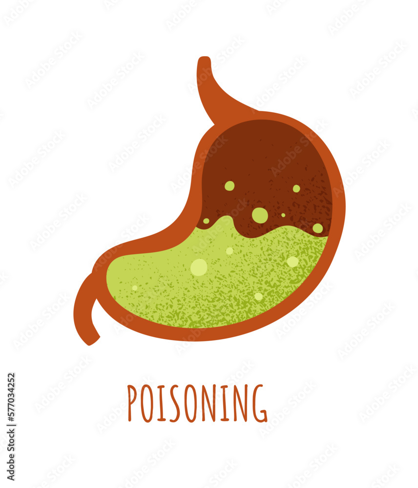 Poisoning stomach concept. Vomiting and food poisoning, indigestion ...