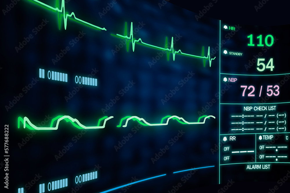 Patient monitor showing vital signs ECG and EKG. Stock Illustration ...