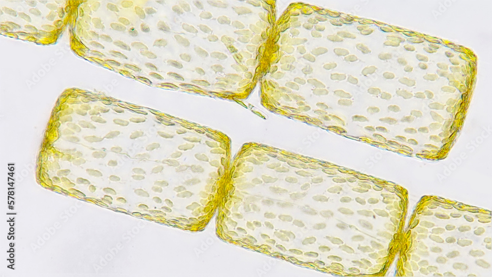 Lauderia sp, a marine phytoplankton from diatom group. Lugol preserved ...