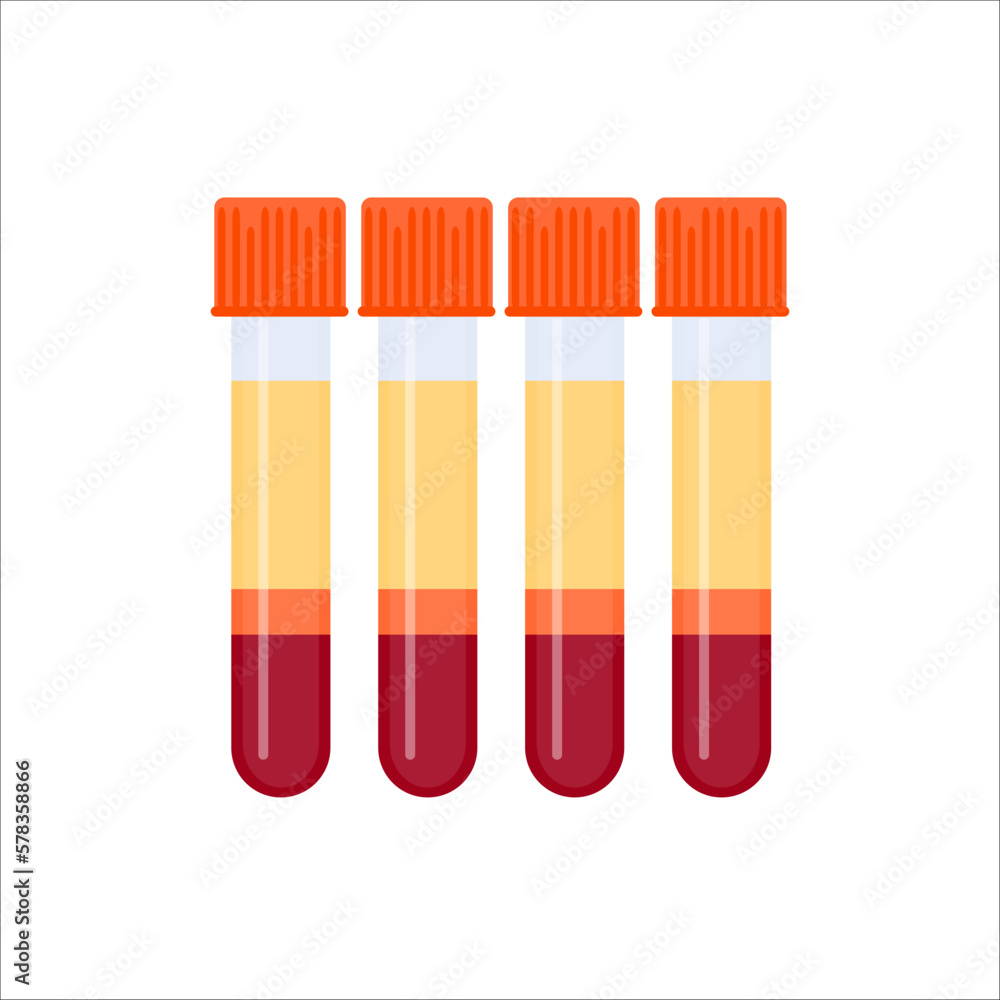 PRP blood test tubes after separation of platelets in the centrifuge ...