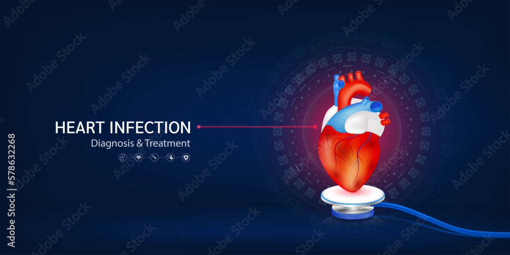 Heart Infection disease, Human heart model float away from stethoscope ...