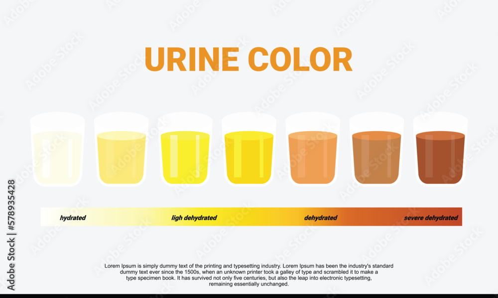 Illustration of urine color chart Stock Vector | Adobe Stock