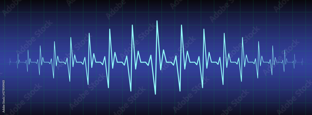 ecg, ekg monitor with cardio diagnosis illustration. Heart rhythm line ...