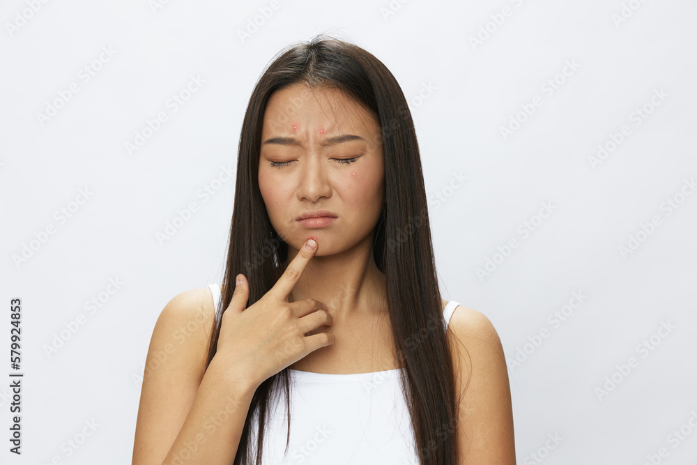 Asian woman facial skin problems, acne and inflammation, red rashes and ...