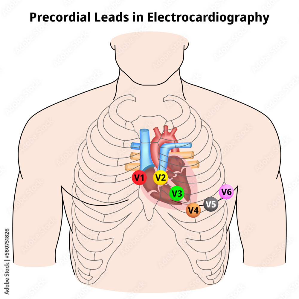 Vector de Stock Precordial Leads in Electrocardiography - V1, V2, V3 ...