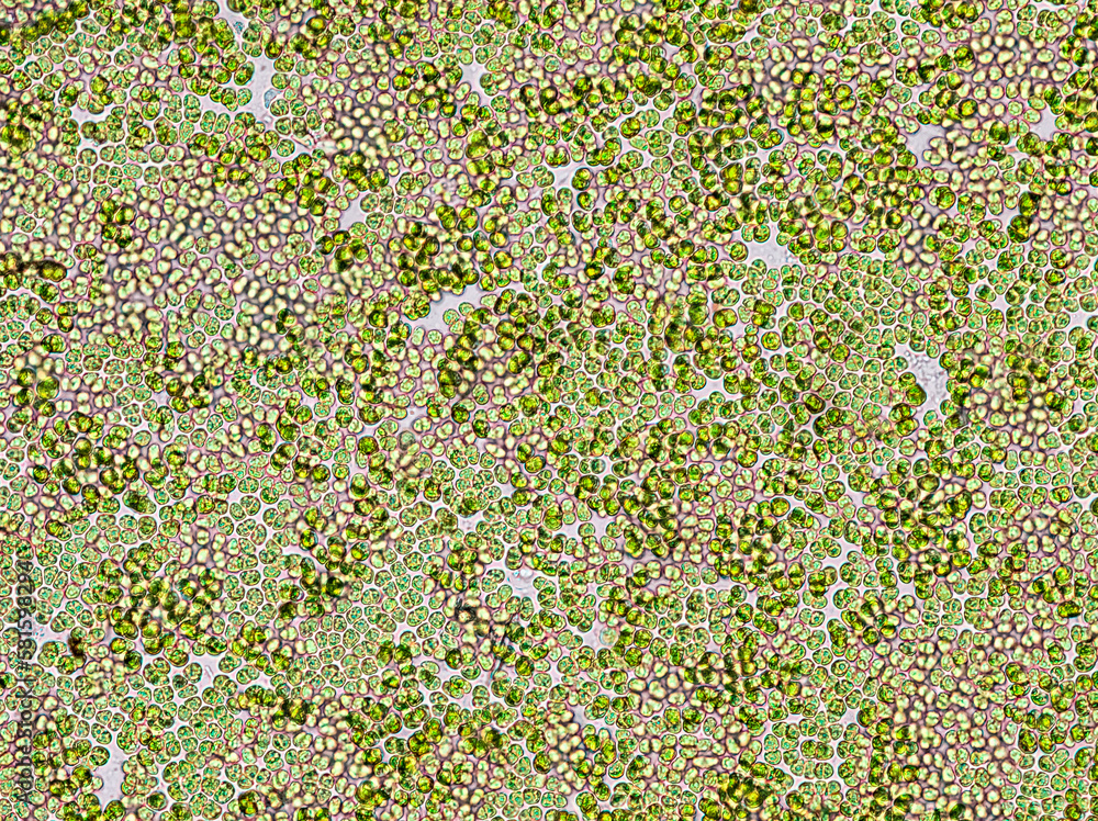 Foto de Stock freshwater unicellular green algae under the microscope ...