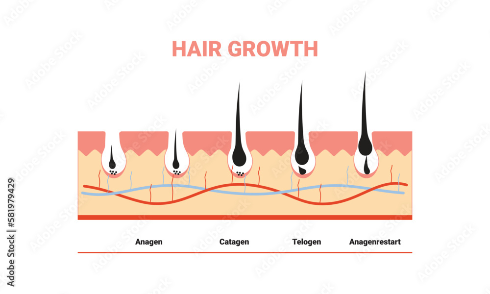 Anatomical training poster. Hair growth phase step by step. Stages of ...