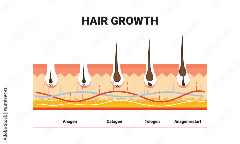 Anatomical training poster. Hair growth phase step by step. Stages of ...