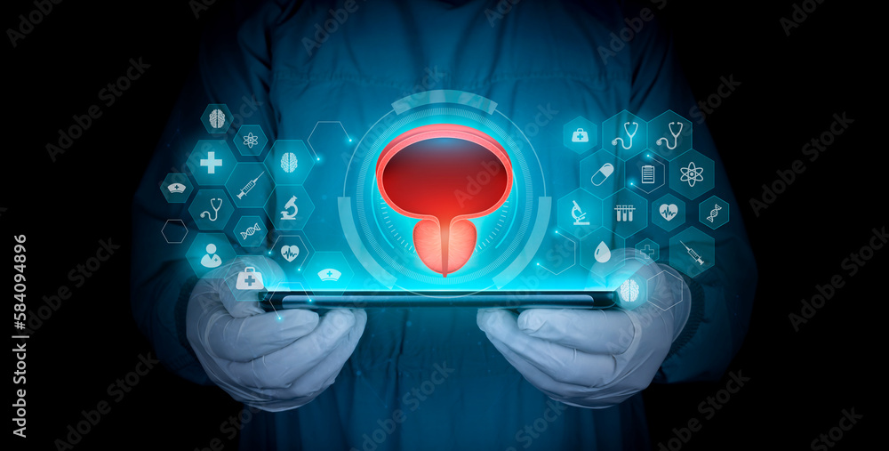 Bladder and prostate in the doctor's hand, HTA. Prostate cancer ...