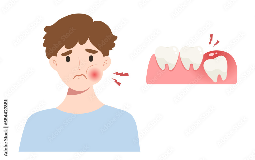 Young man suffering from wisdom tooth. Concept of impacted tooth pain ...