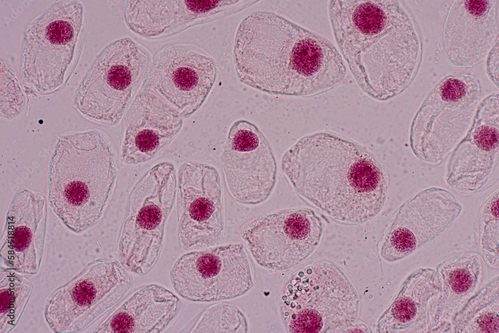 Root tip of Onion and Mitosis cell in the Root tip of Onion under a ...