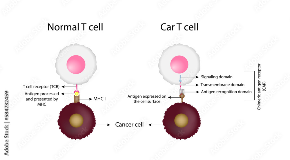 Normal T cell and Chimeric antigen receptor T cell ,CAR T cell, for use ...