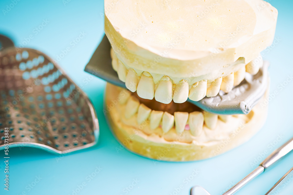 dental prosthetic plaster teeth, dental braces Stock Photo | Adobe Stock