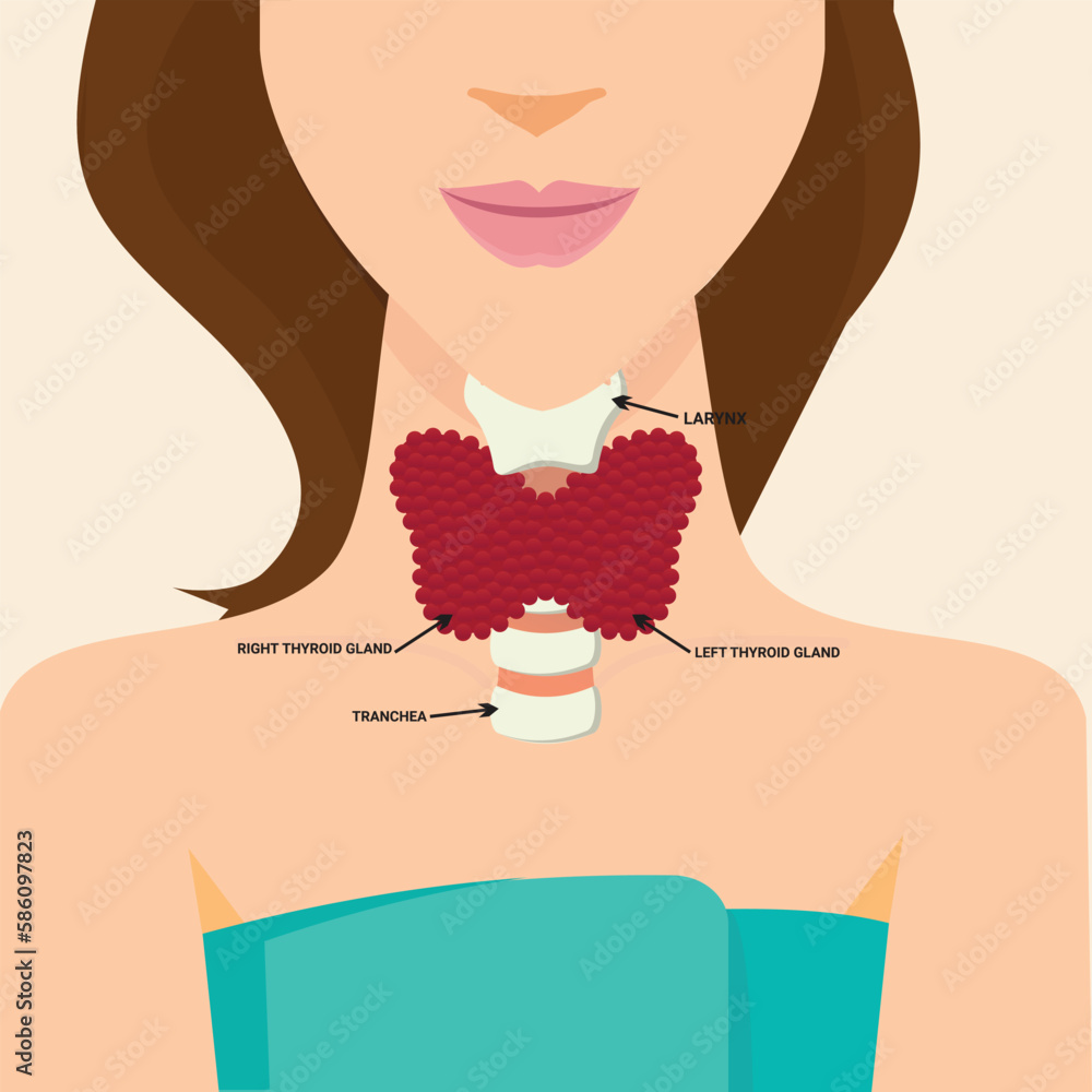 Thyroid gland vector illustration. Thyroid gland and trachea shwn on a ...