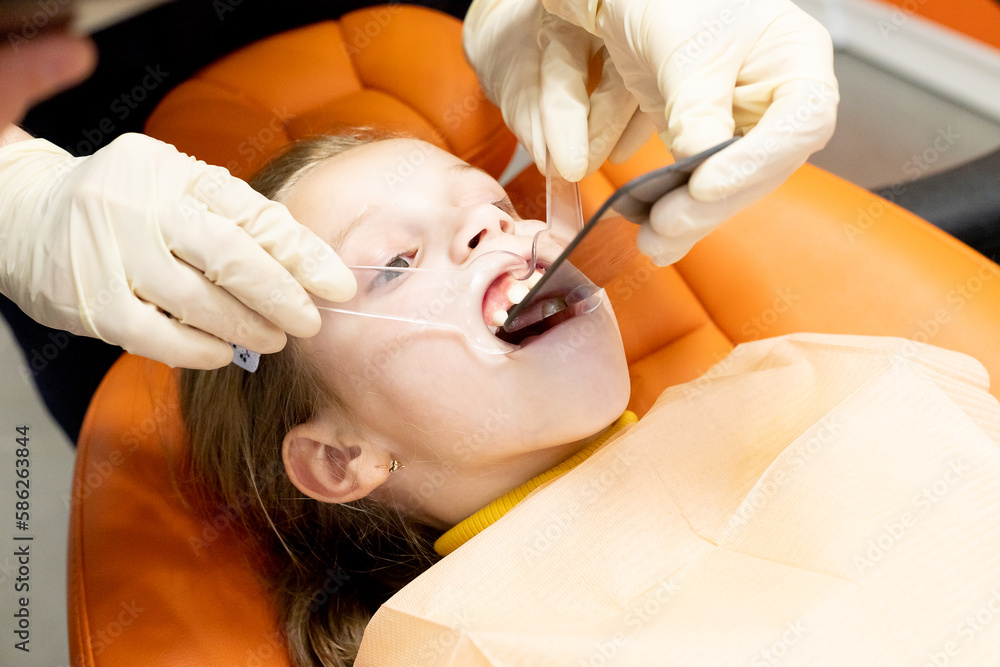 male dentist bent over a child looks at her jaw. Child during ...