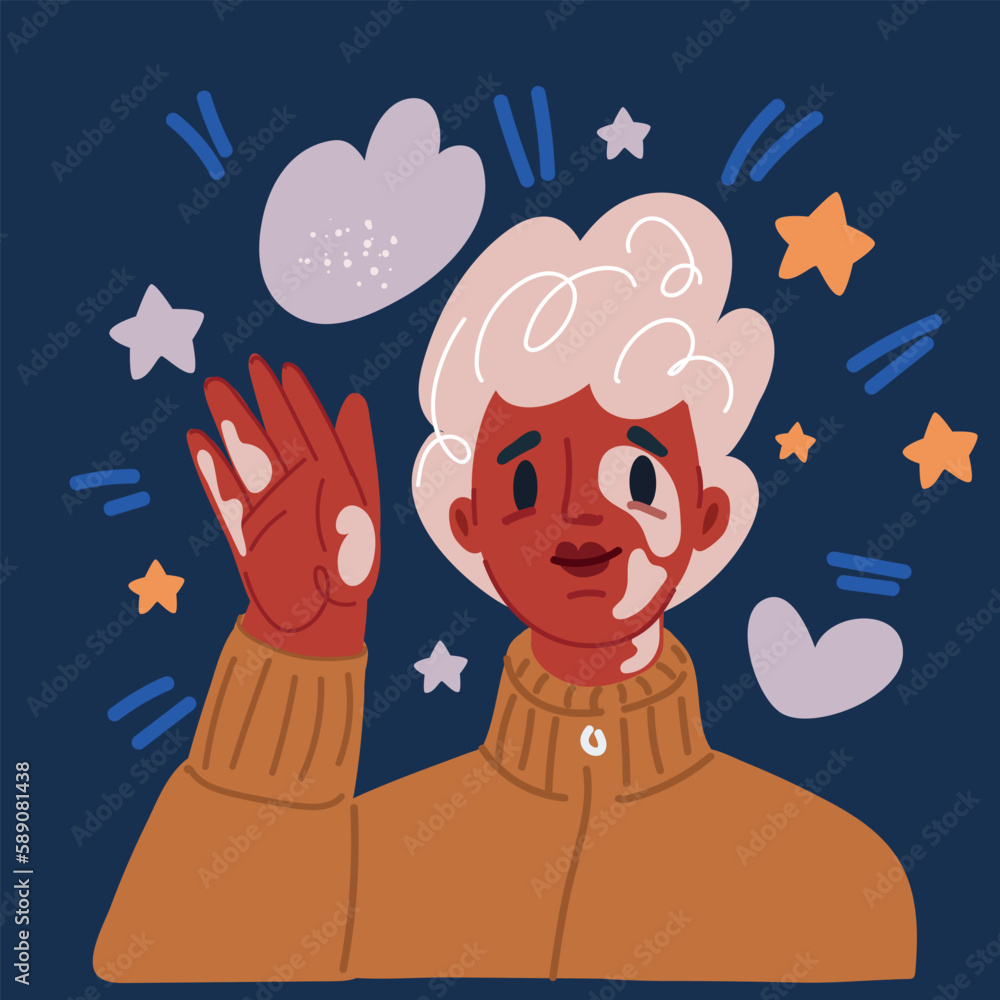 Cartoon vector illustration of Black girl with vitiligo Stock Vector ...