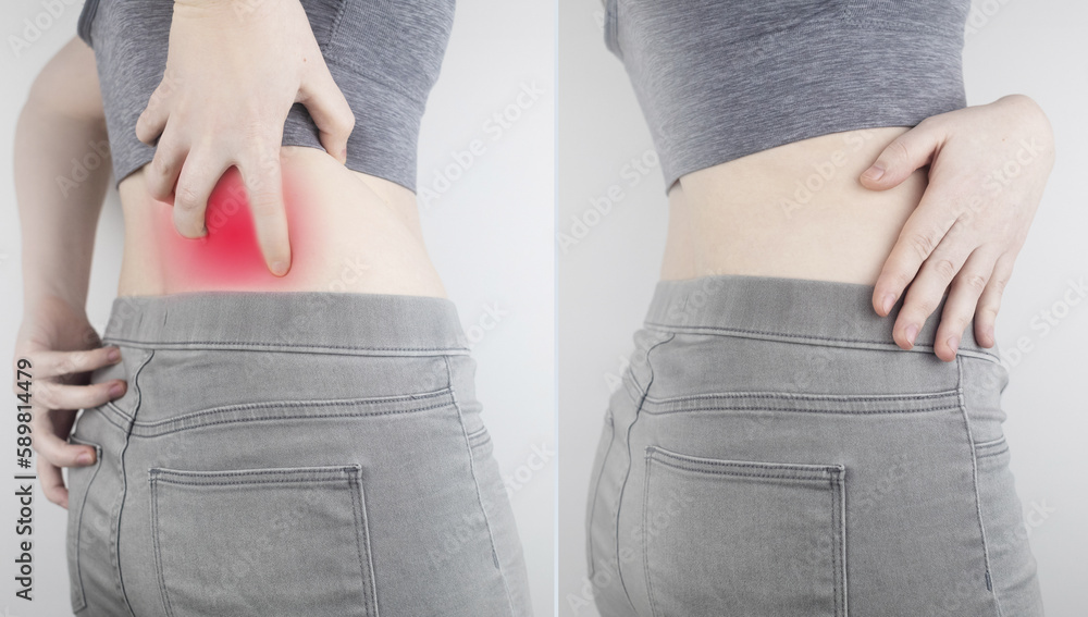 Pain behind the back. Pyelonephritis and kidney disease. Stretching of ...