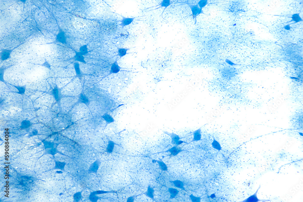 Motor neuron cells, whole mount, 8X light micrograph. Motoneurons under ...