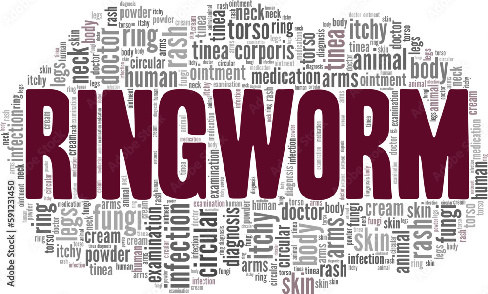 Tinea Corporis - Ringworm word cloud conceptual design isolated on ...