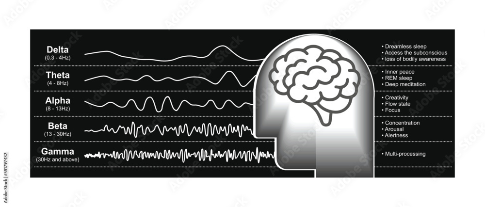 Different kinds of waveforms are produced by brain activity ...