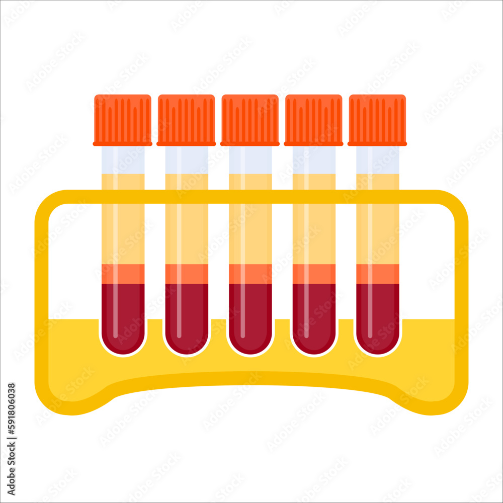 Laboratory tube rack with PRP blood collection tubings after separation ...