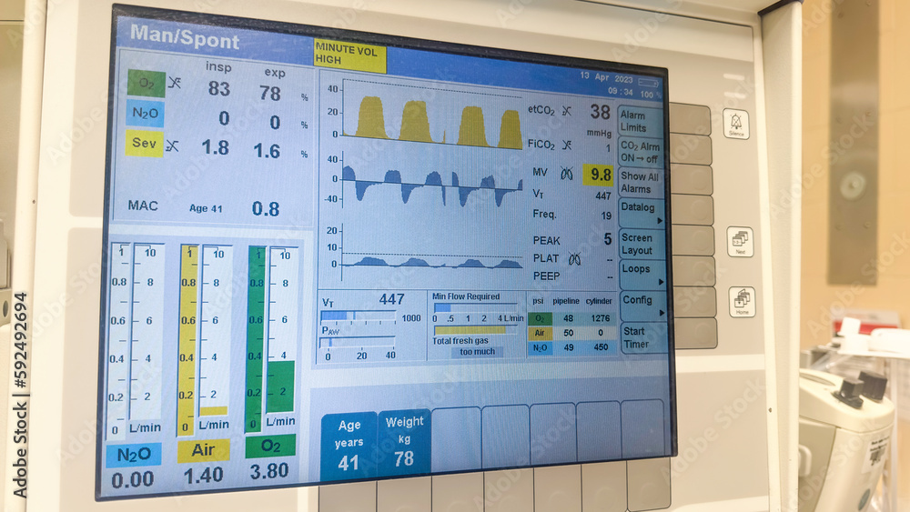 hospital anesthesia machine with attached medical equipment such as ...