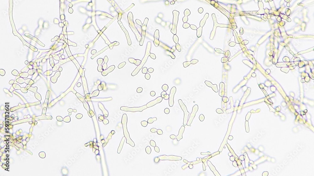 Neurospora sp. under microscope. Sample collected from corncob. Fresh ...