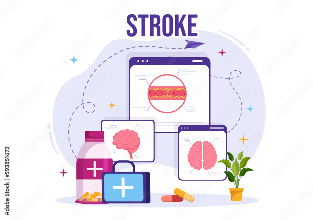 Human Brain Stroke Vector Illustration with Scientific Medical ...