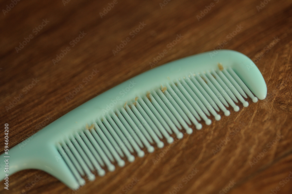 Childhood seborrheic dermatitis on the comb Stock Photo | Adobe Stock