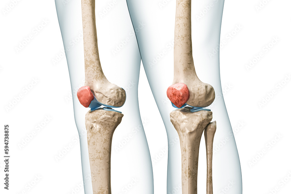 Patella or kneecap bone in red color with body 3D rendering ...