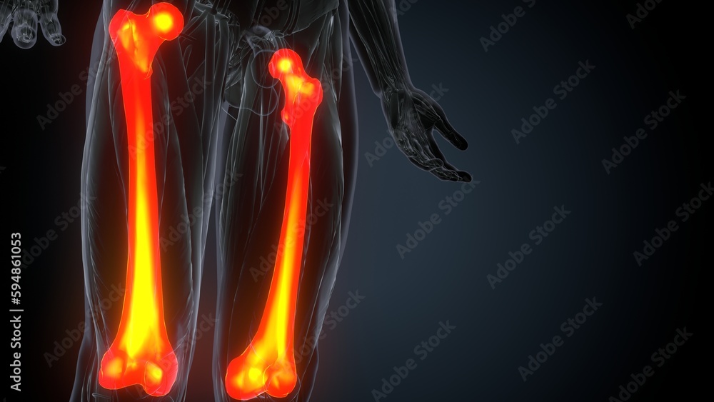 3d illustration of human body femur bone anatomy Stock Illustration ...