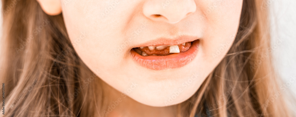 Charming smiling little girl kid with opened mouth shows staggering ...