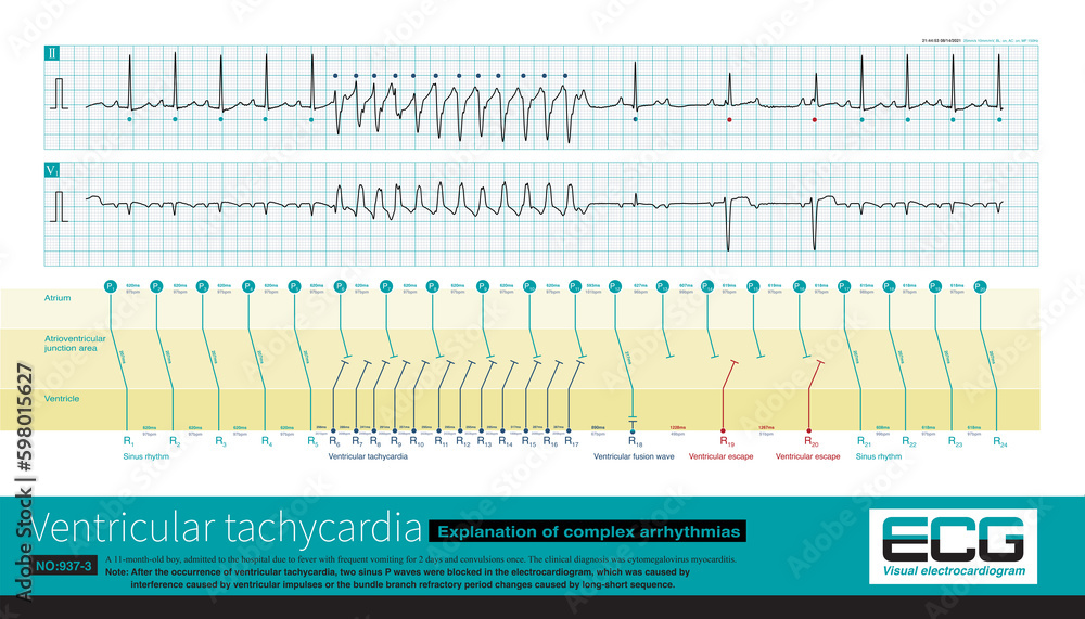 Illustration Stock An 11 month old male infant was clinically diagnosed ...