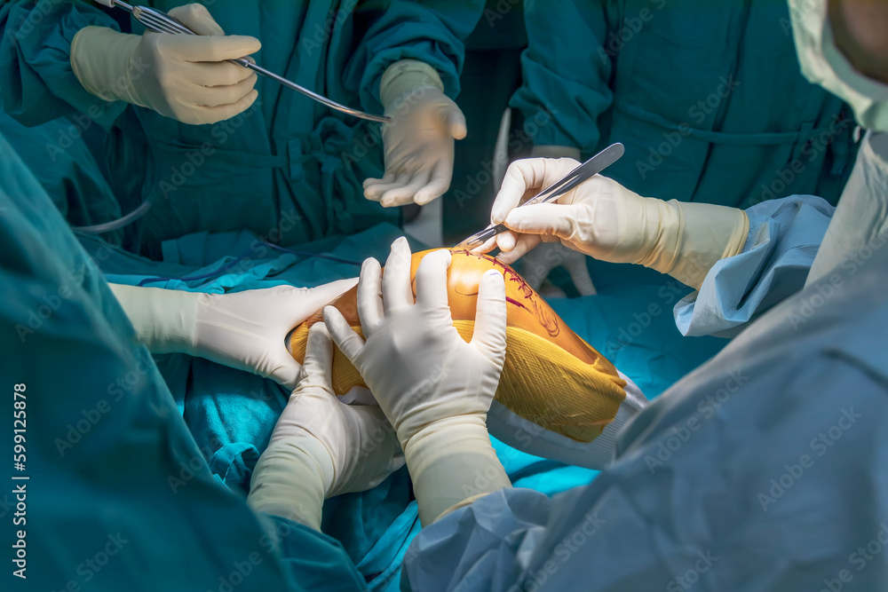 Doctor or orthopedic surgeon in green uniform holding medical scalpel ...