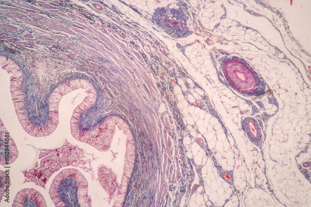 Histological Uterus human, Uterine tube human, Placenta human and ...