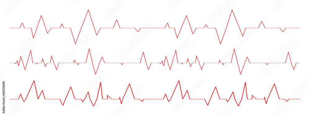 Set of heartbeat diagrams. ECG charts isolated on white background ...